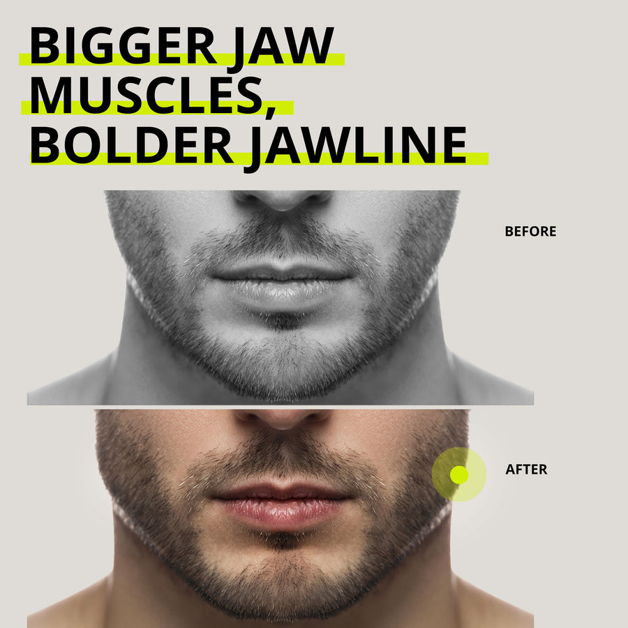 JAWLINER 3.0 Bundle | 3 jaw trainers in 3 levels of resistance